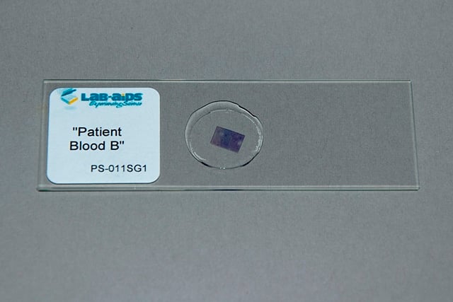 Patient B Blood, Prepared Slide | Lab-Aids